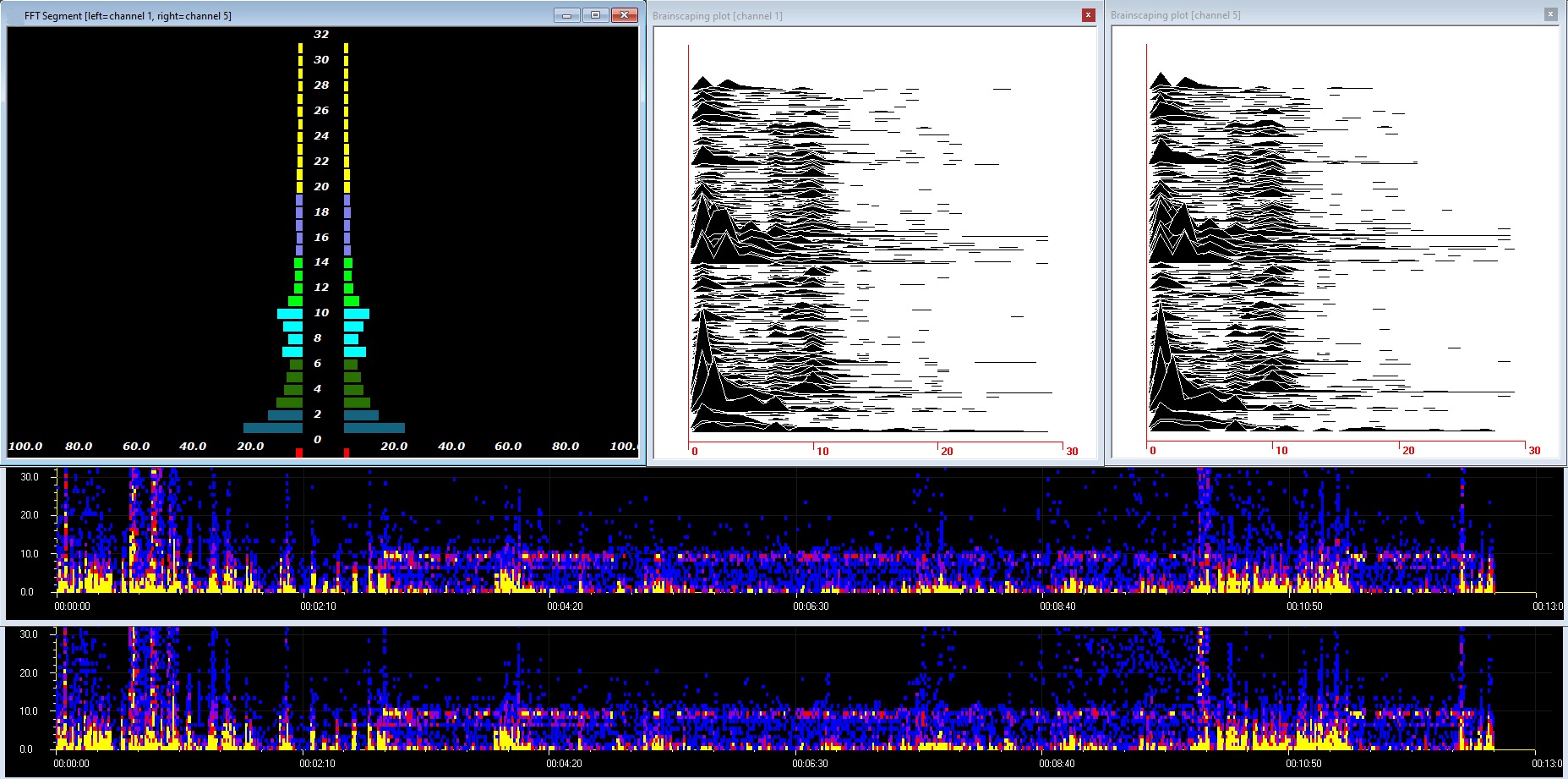 Brainwave III: Advanced Light-Sound Neurofeedback System